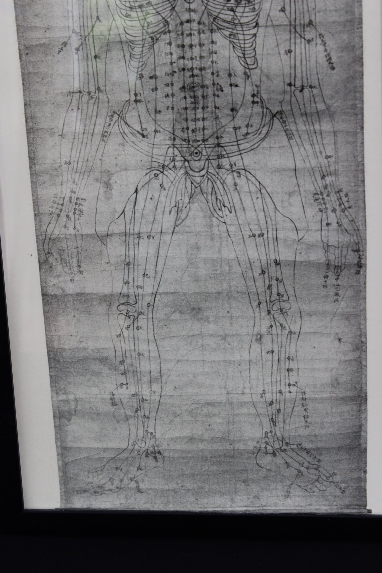 Pair Of Framed Black And White Chinese Acupuncture Charts Of ...