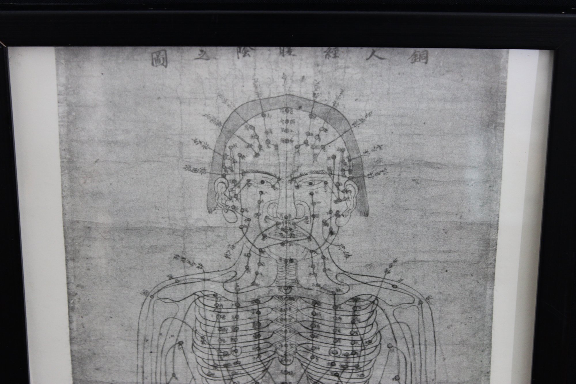 Pair Of Framed Black And White Chinese Acupuncture Charts Of ...