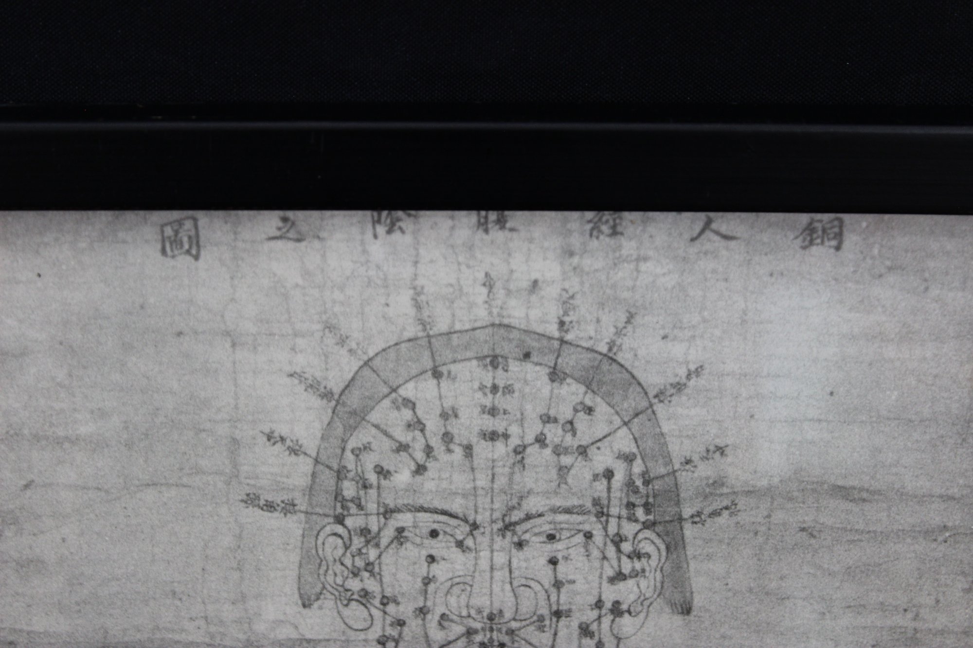 Pair Of Framed Black And White Chinese Acupuncture Charts Of ...